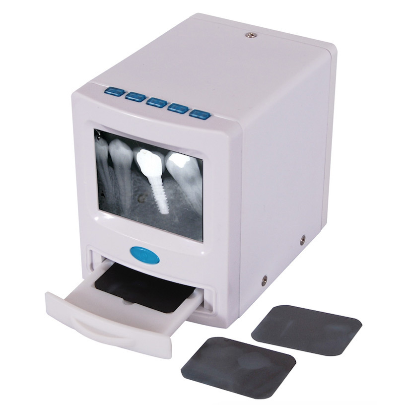 Professional Medical Dental Equipment No Radiation Dental X Ray Camera ...