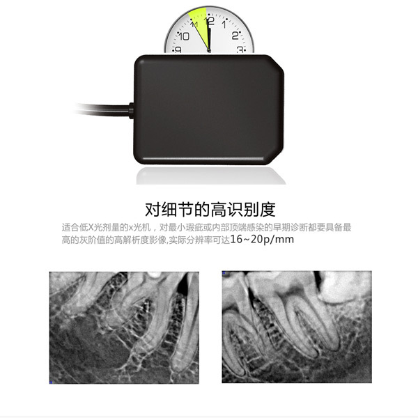 China Dental X ray Sensor USB Handy Digital System