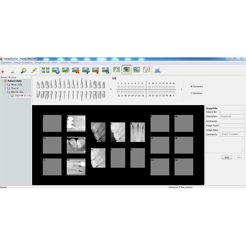 China Dental X ray Sensor USB Handy Digital System