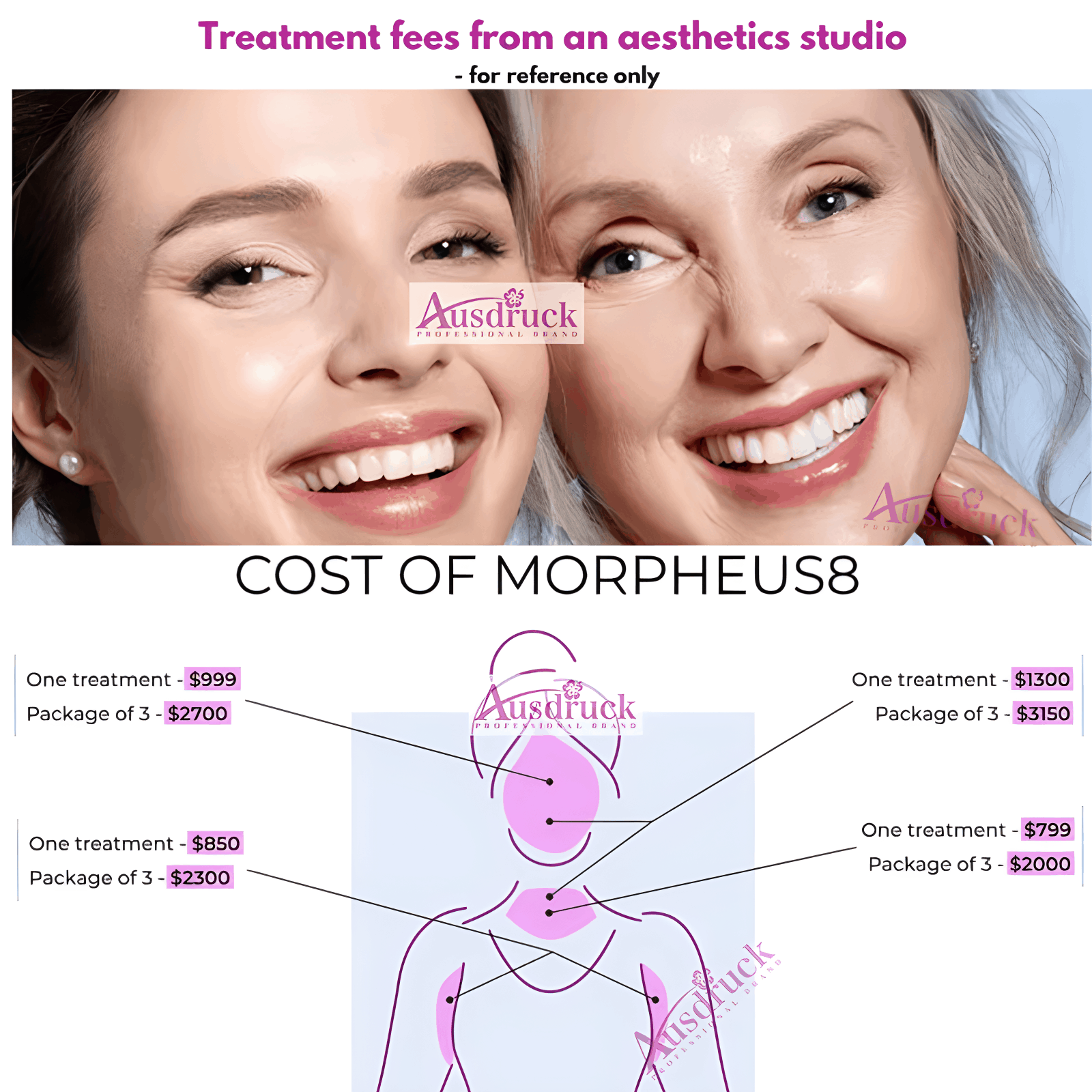 Morpheus 8 Advanced RF Microneedle Therapy System with Ice Hammer ...