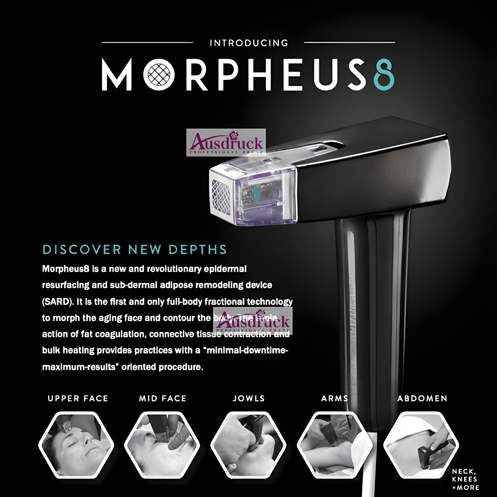Morpheus 8 Advanced RF Microneedle Therapy System with Ice Hammer - Deep Skin Rejuvenation ...