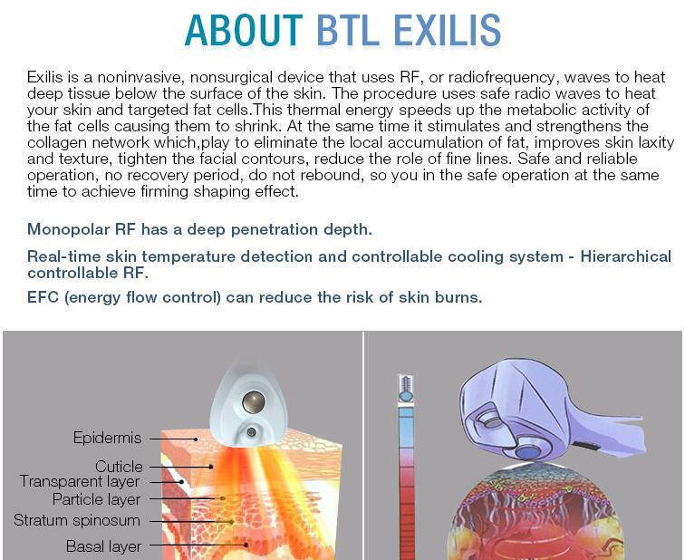 BTL Exilis Elite Cellulite Reduction Focused RF Ultrasound Slimming Machine